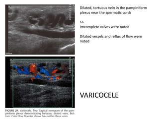 Scrotum echo | PPTX