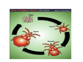 Scrub typhus | PPT