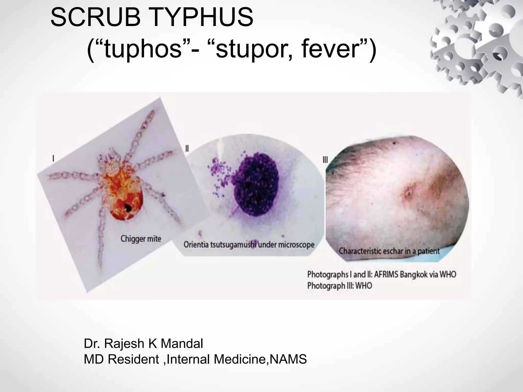 Scrub typhus | PPTX