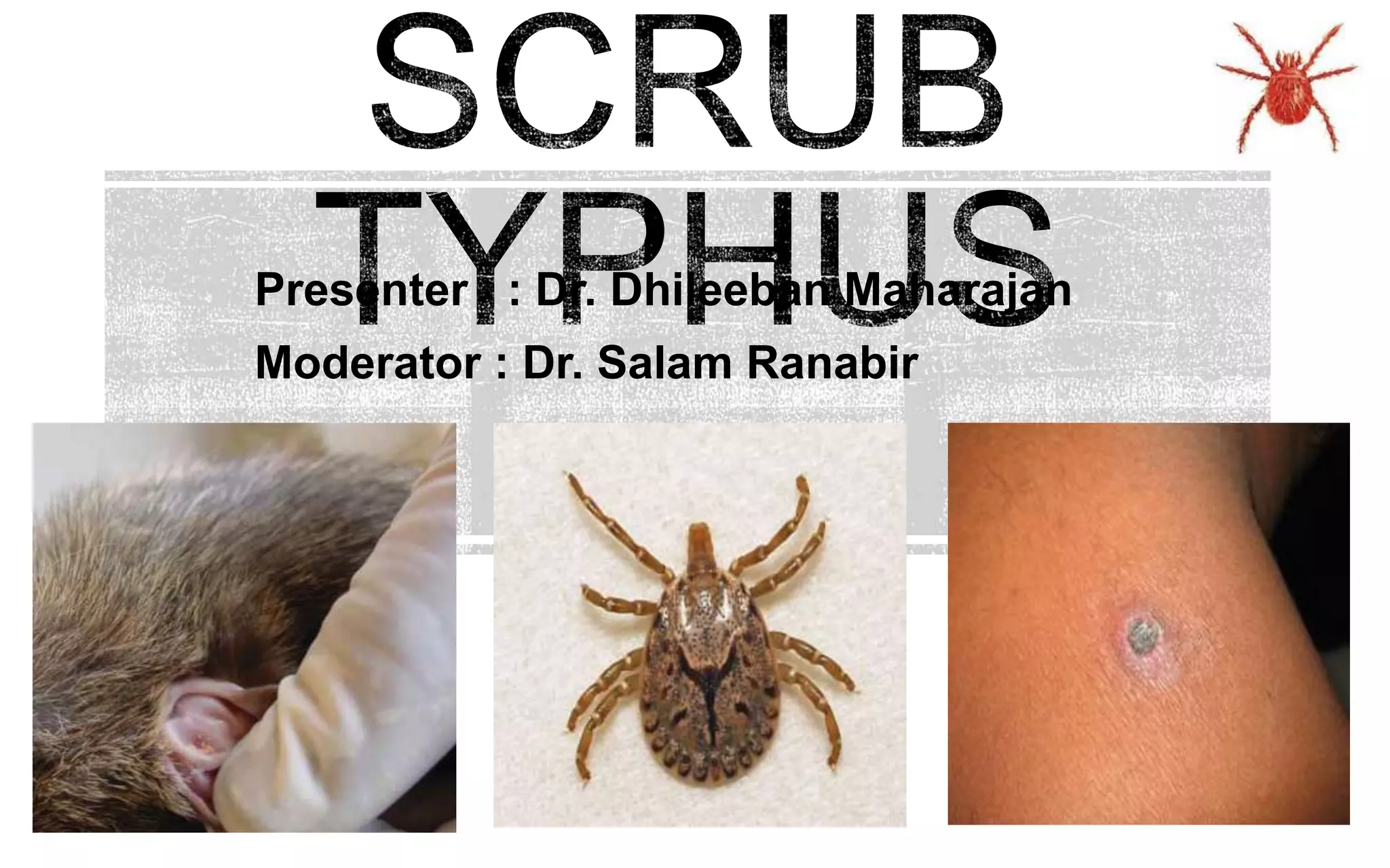 Scrub typhus | PPTX | Infectious Diseases | Diseases and Conditions