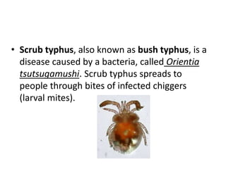 Scrub typhus | PPT