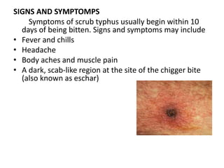 Scrub typhus | PPT