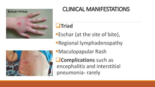 Scrub typhus | PPT