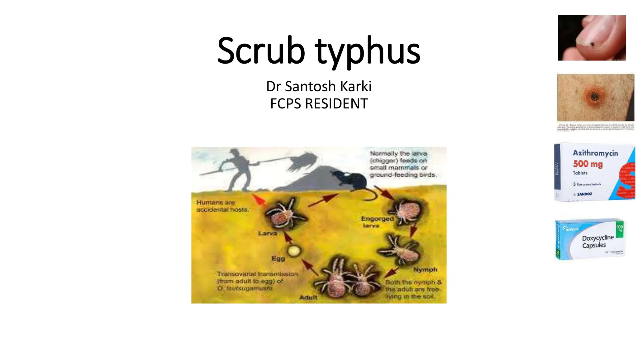 scrub typhus.pptx dr.ramjiban yadav nepal | PPTX