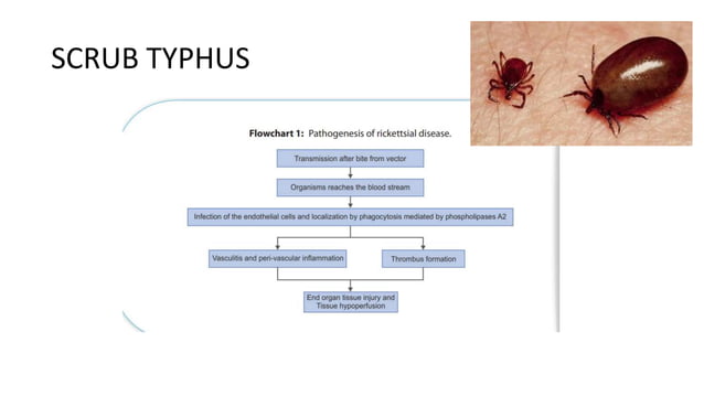 Scrub typhus PowerPoint presentation for ug students | PPT