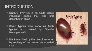 SCRUB TYPHUS general medicine mbbs final | PPT
