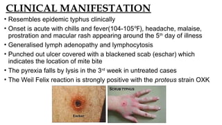 presentation on chn diseases SCRUB typhus.pptx