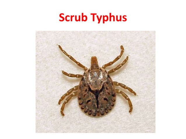 scrub Typhus- Dr. Mausumi saha.ppt
