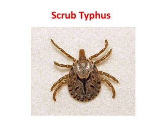 scrub Typhus- Dr. Mausumi saha.ppt