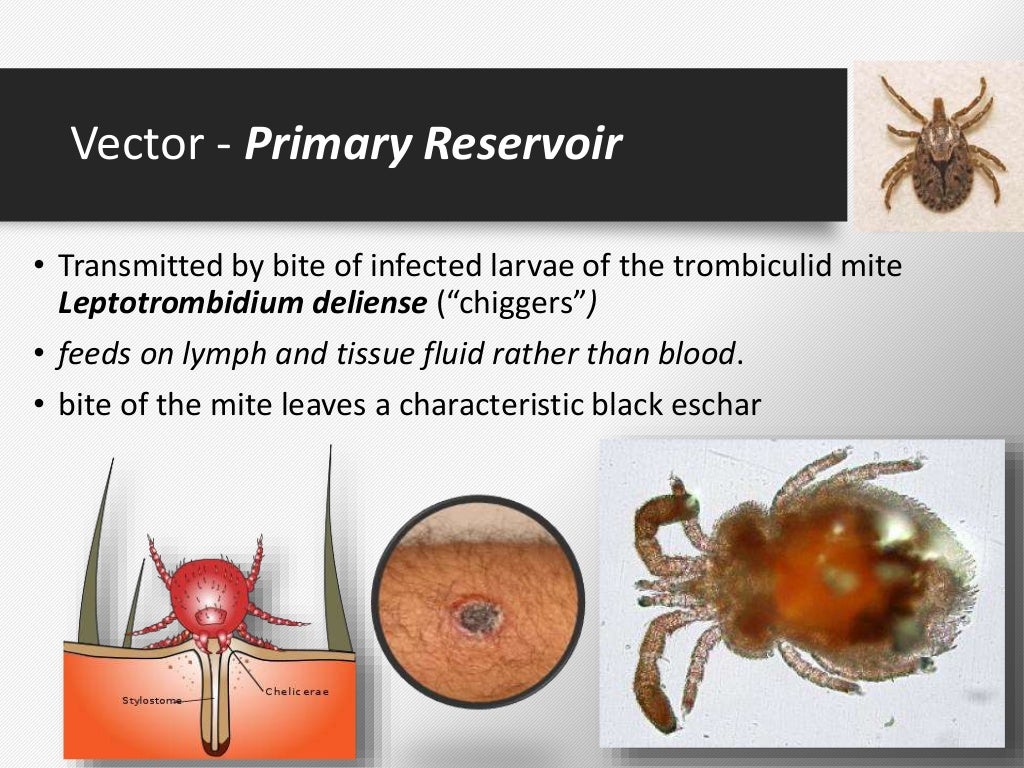 Scrub typhus 2016 Epidemiology - Symptoms - Diagnosis - Management