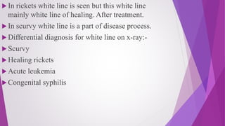 Scurvy and Osteogenesis imperfecta | PPTX