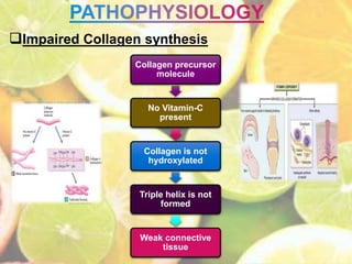 Vitamin-C deficiency disease Scurvy. | PPTX