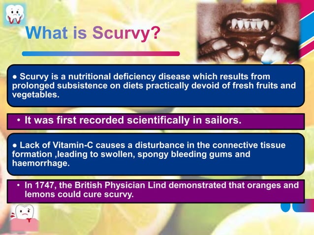Vitamin-C deficiency disease Scurvy. | PPTX