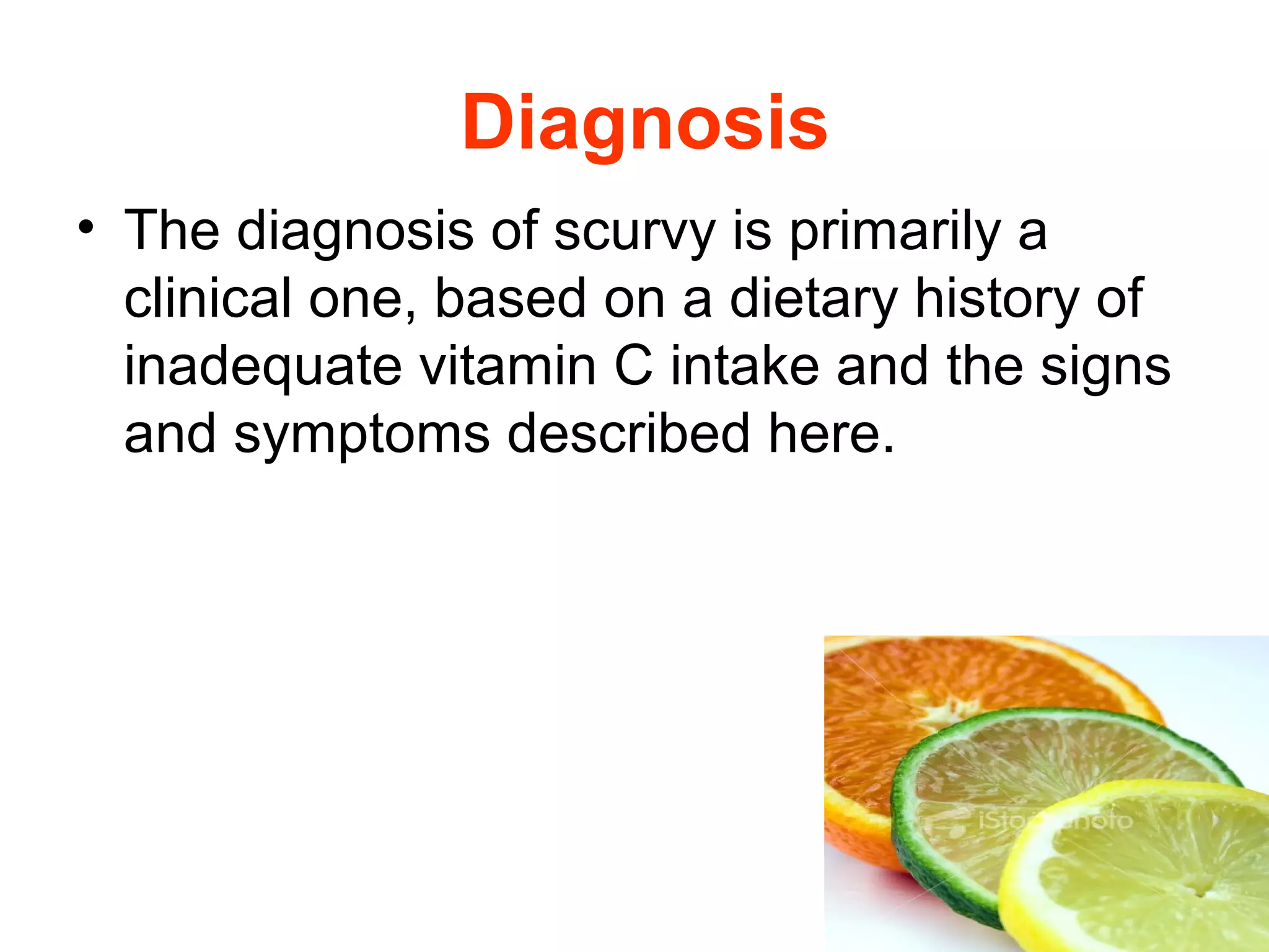 Scurvy Disease | PPT