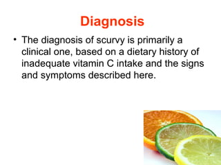Scurvy Disease | PPT
