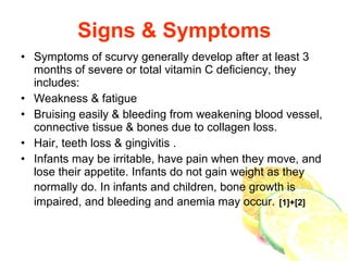 Scurvy Disease | PPT