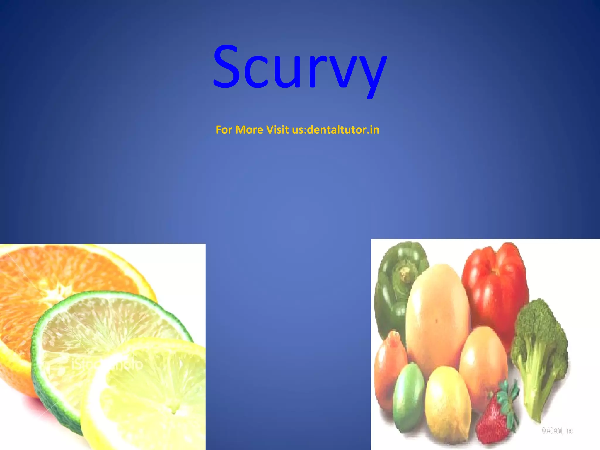 Scurvy | PPT