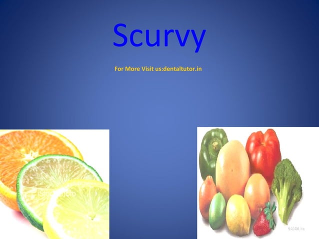 Scurvy | PPT | Nutrition | Healthy Living