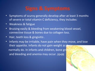 Scurvy | PPT