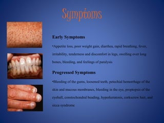 Scurvy | PPT