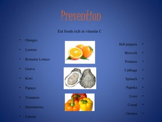 Scurvy | PPT