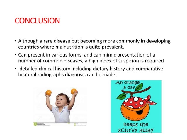 Scurvy in children | PPTX | Bone and Joint Conditions | Diseases and ...
