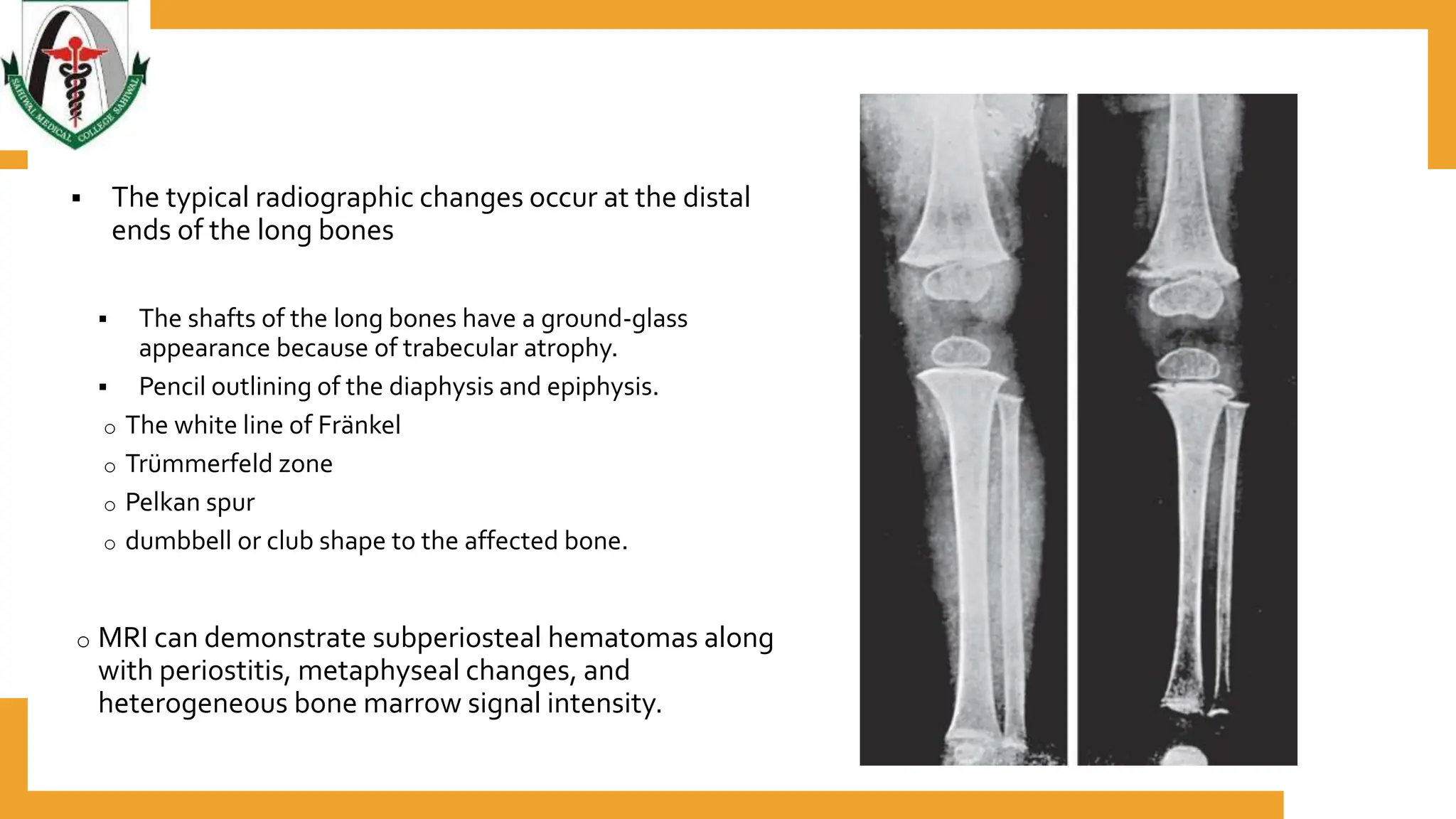 scurvy case scanario and description final.pptx
