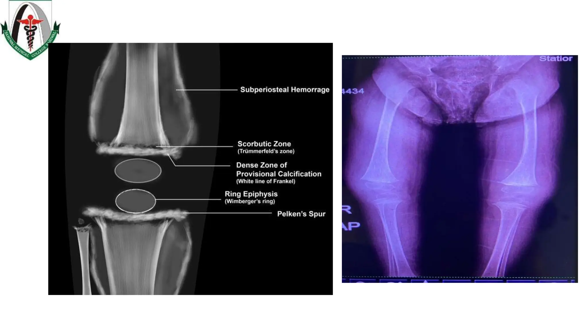 scurvy case scanario and description final.pptx