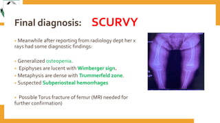 scurvy case scanario and description final.pptx