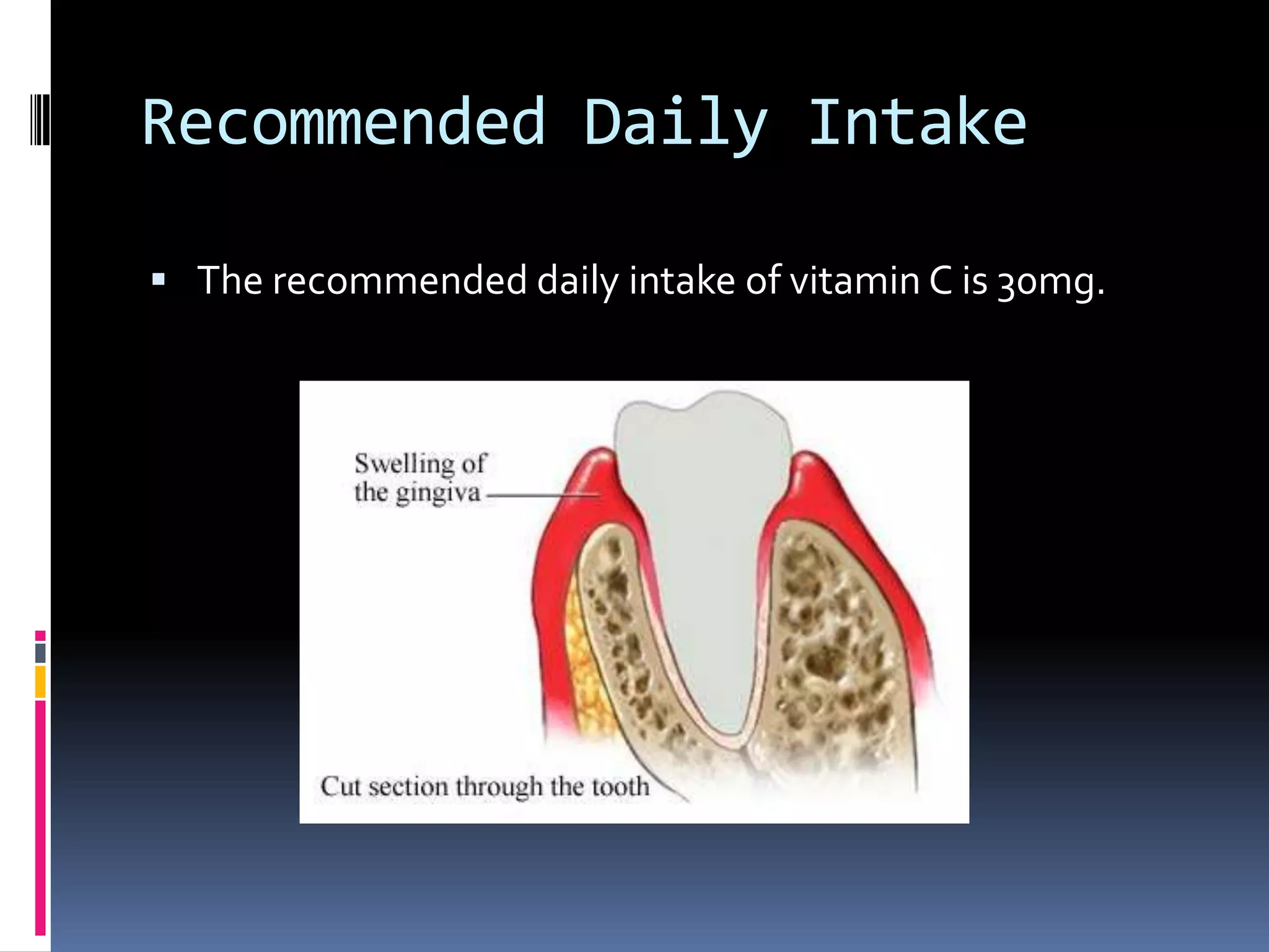 Scurvy Presentation | PPTX