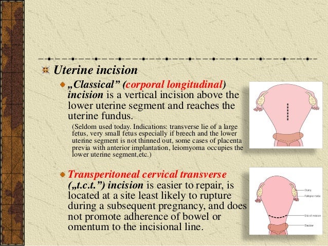 Inverted Y Perineal Incision Deepened Through