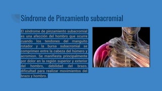 Sd. Pinzamiento subacromial.pptx