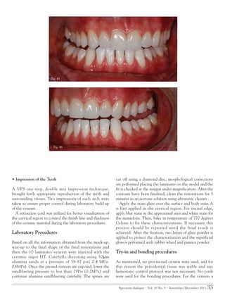 Sd v10 n9-lithium disilicate veneers-dr.adolfi | PDF