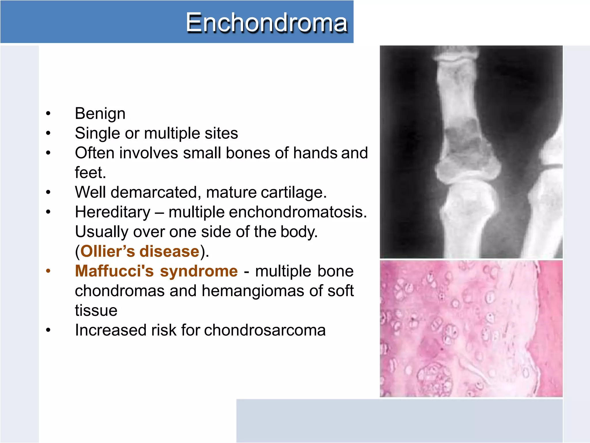 Pathology of bone tumors | PPTX