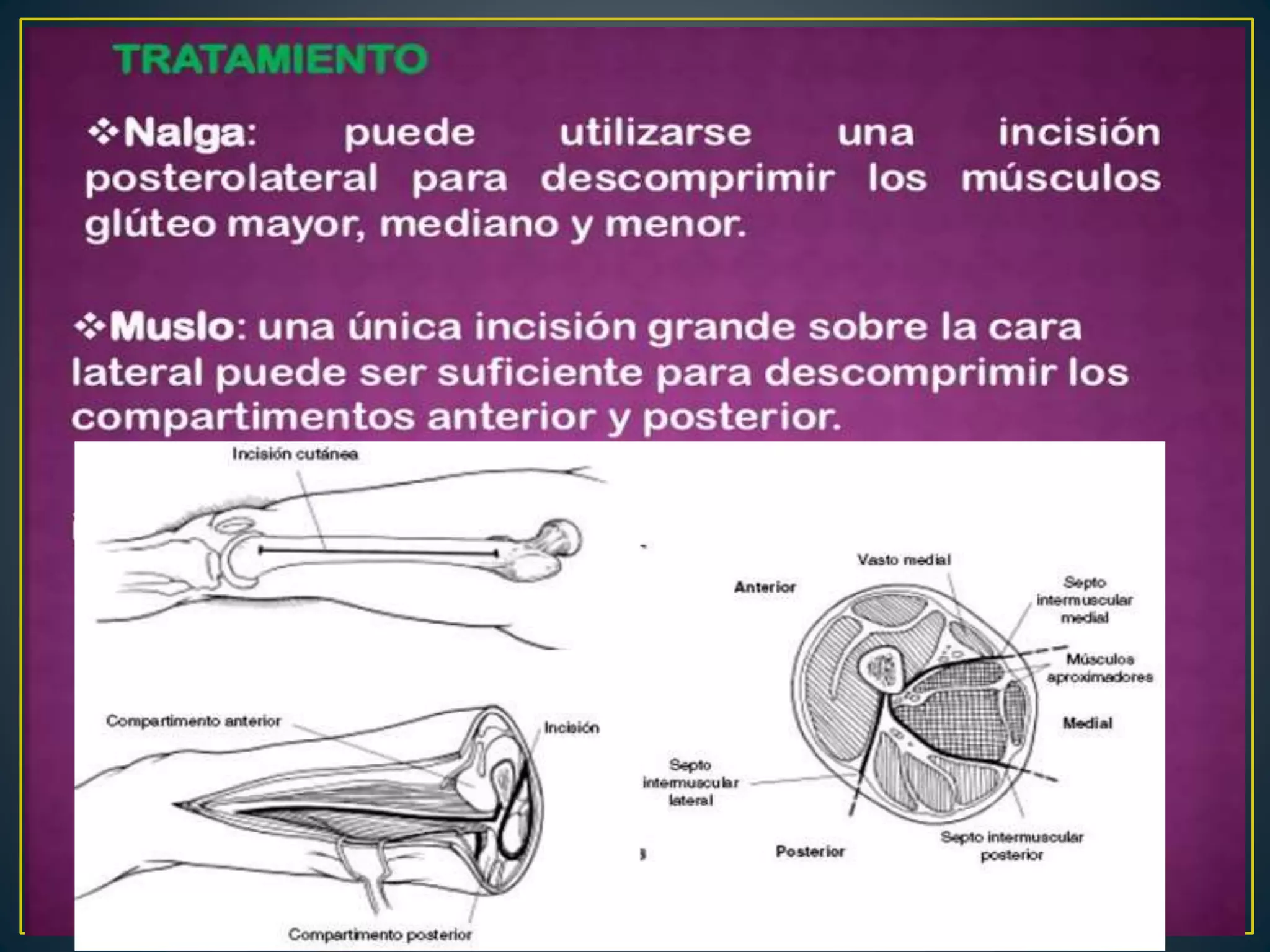 Sindrome compartimental y atrofia de sudeck | PPT