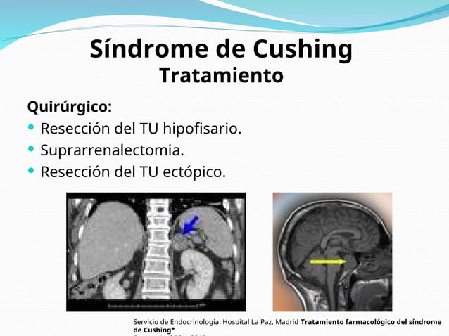 Sd Cushing fisiopatología 2017.......... | PPT