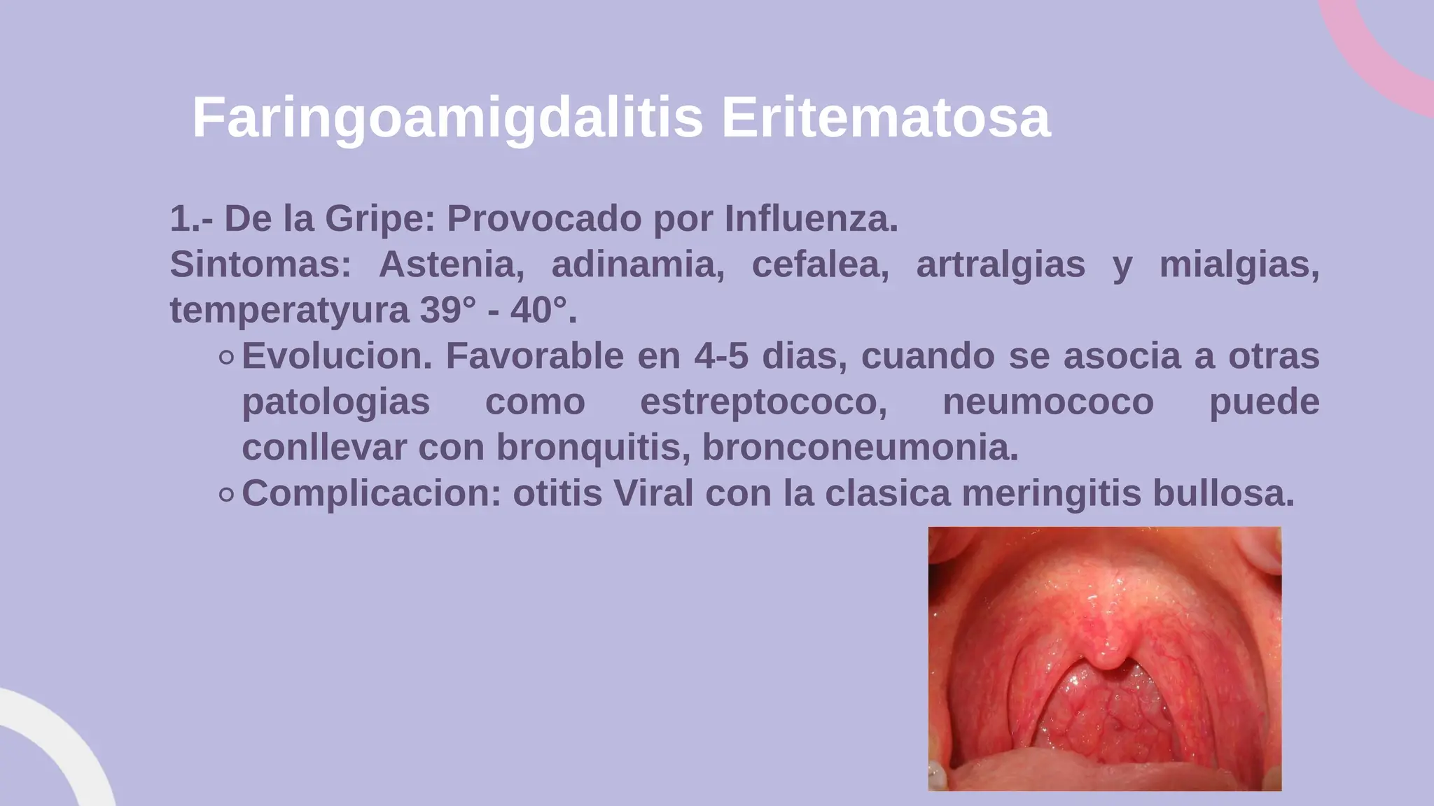 procesos inflamatorios de la Faringe.pptx