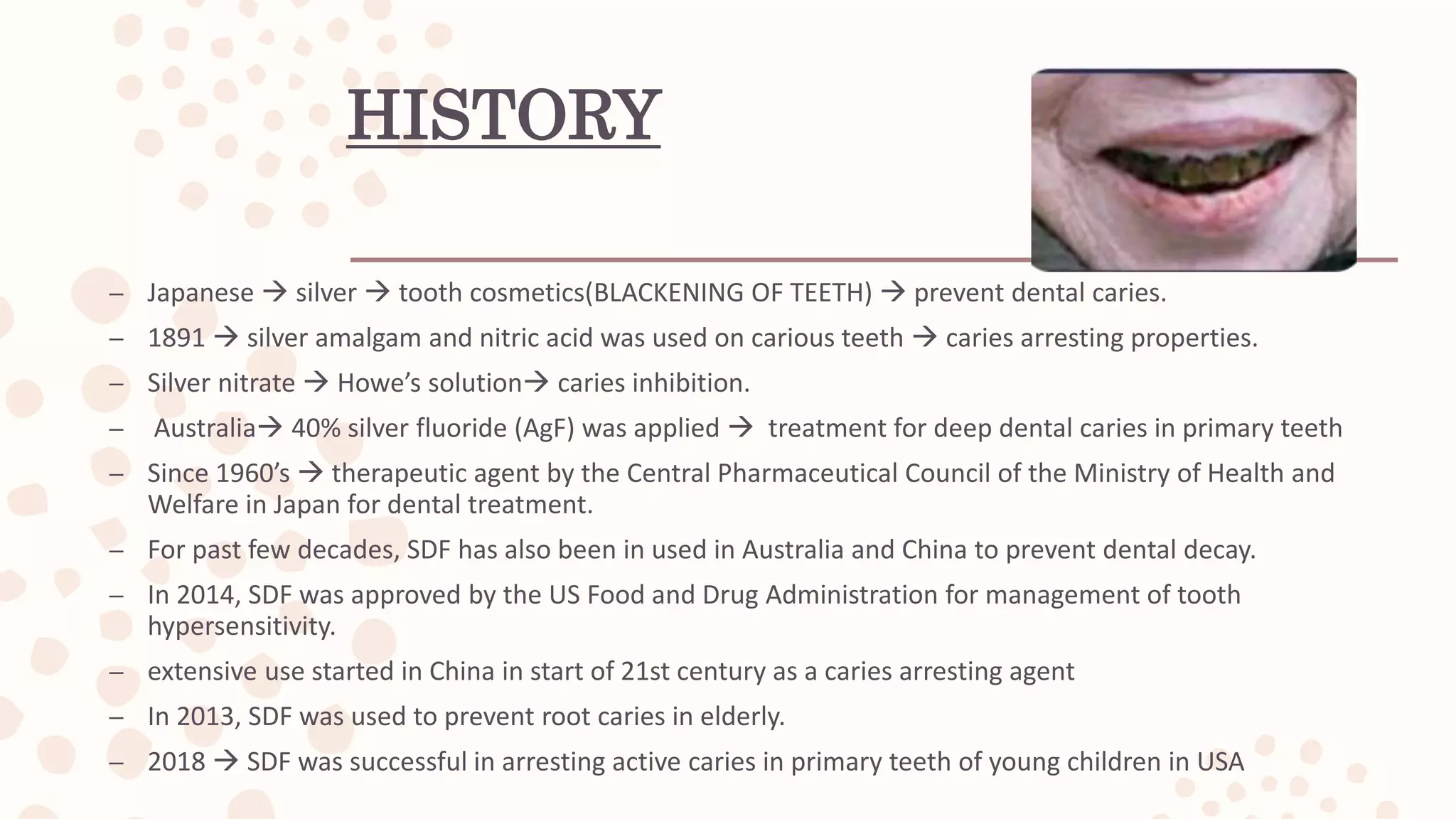 SILVER DIAMINE FLUORIDE (SDF) | PPTX