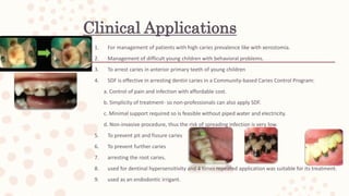 SILVER DIAMINE FLUORIDE (SDF) | PPTX