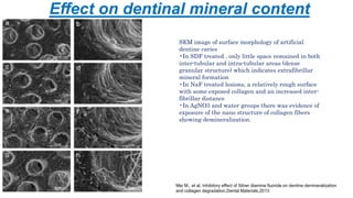 Silver Diamine Fluoride | PPTX