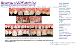Silver Diamine Fluoride | PPTX