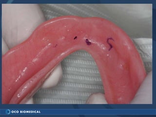 OCO Biomedical SDI Case | PPTX