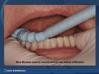 OCO Biomedical SDI Case | PPTX