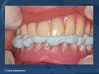 OCO Biomedical SDI Case | PPTX