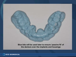 OCO Biomedical SDI Case | PPTX