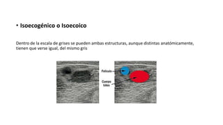 Ecografia y evaluacion_seminal | PPTX