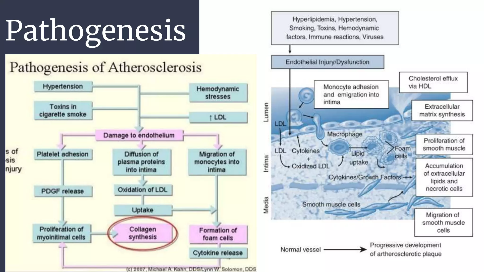 Atherosclerosis and it’s complications | PPTX | Heart and ...