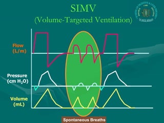 Mechanical ventilator22222222222222 .ppt