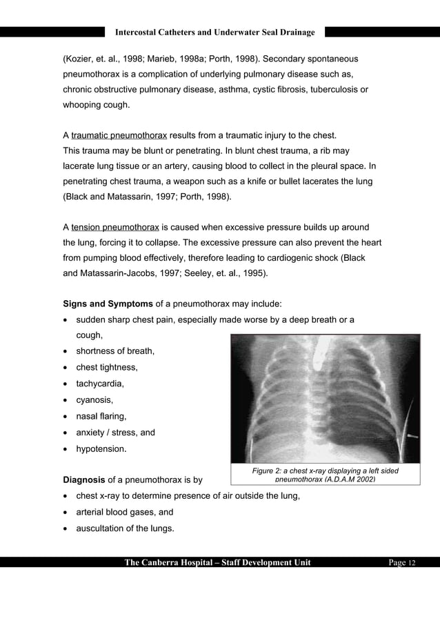 SDLP: ICC and UWSD | DOC | Lung and Respiratory Health | Diseases and ...