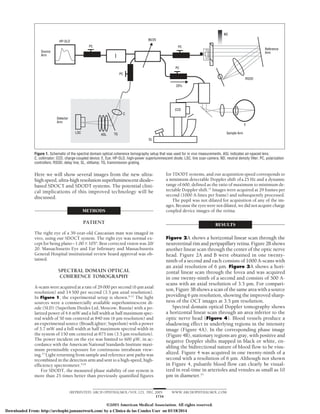 Sd oct | PDF